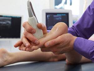 Doppler Circulation Assessment Ottawa - Footopia