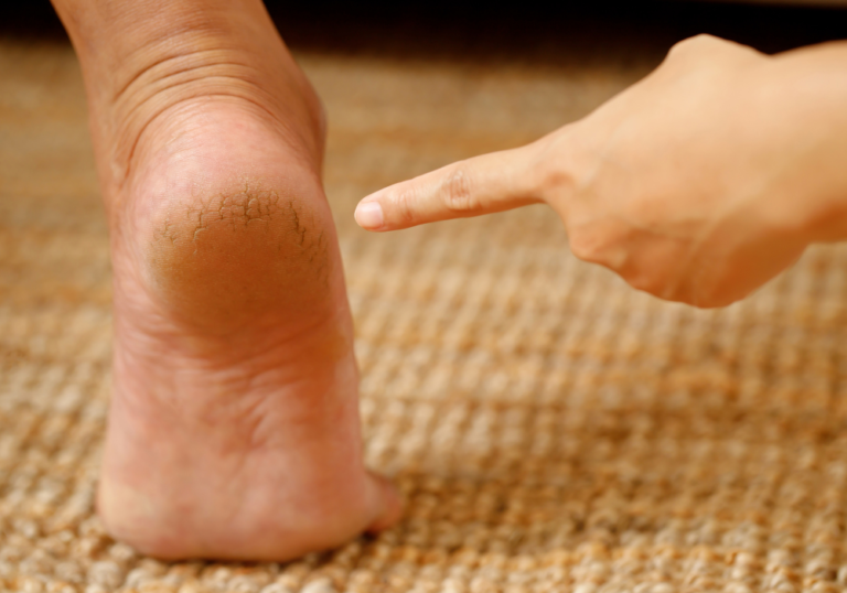 Foot Care Clinic Ottawa | Foot Specialist | Foot Care Treatments